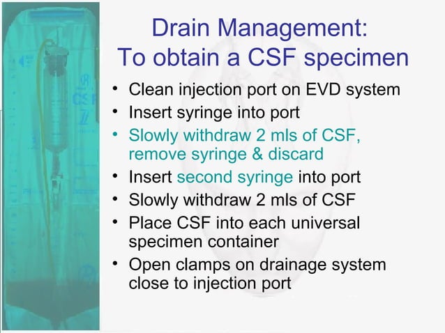 External Ventricular Drain | PPT