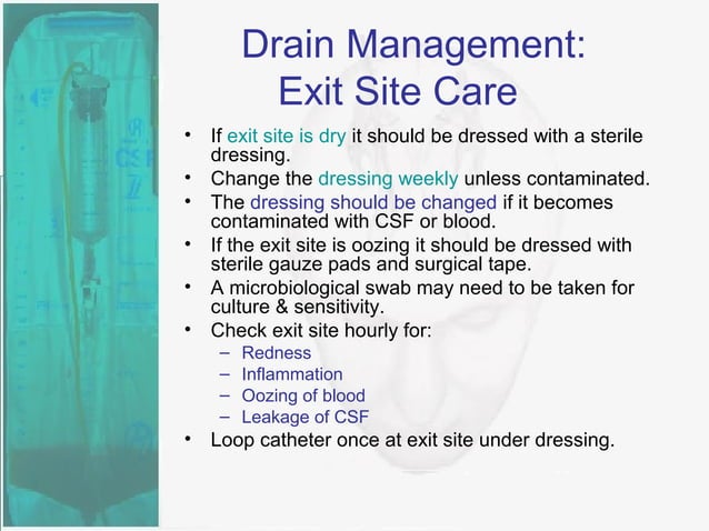 External Ventricular Drain | PPT