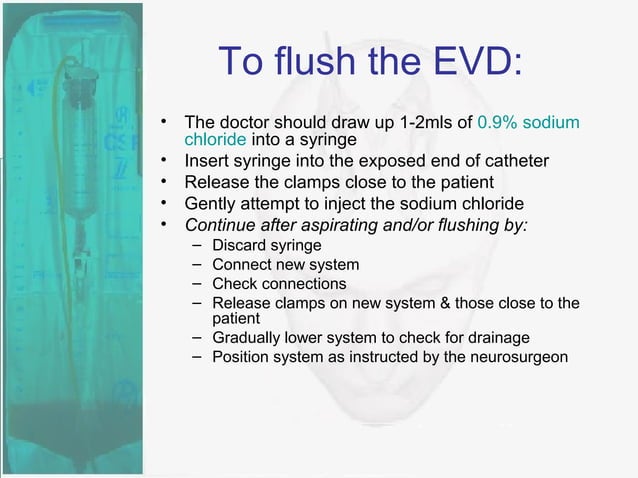 External Ventricular Drain | PPT
