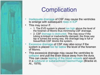 External Ventricular Drain | PPT