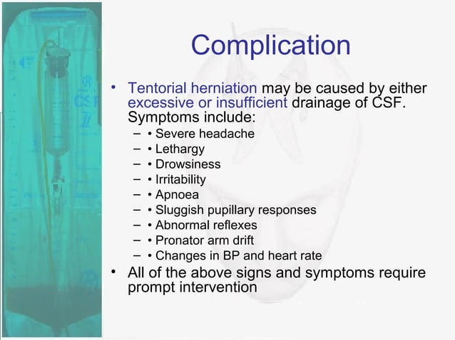 External Ventricular Drain | PPT