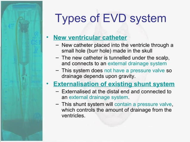 External Ventricular Drain | PPT