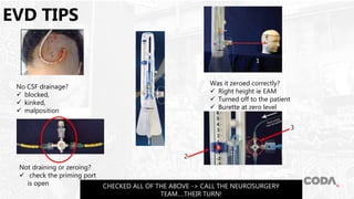 EVD Tips and Tricks | PPTX | Brain and Nervous System Disorders ...