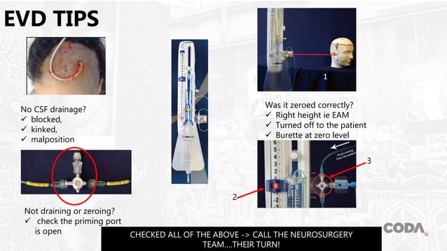 EVD Tips and Tricks | PPTX | Brain and Nervous System Disorders ...