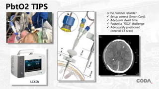 EVD Tips and Tricks | PPTX | Brain and Nervous System Disorders ...