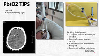EVD Tips and Tricks | PPTX | Brain and Nervous System Disorders ...