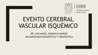EVENTO CEREBRAL VASCULAR ISQUÉMICO.pptx