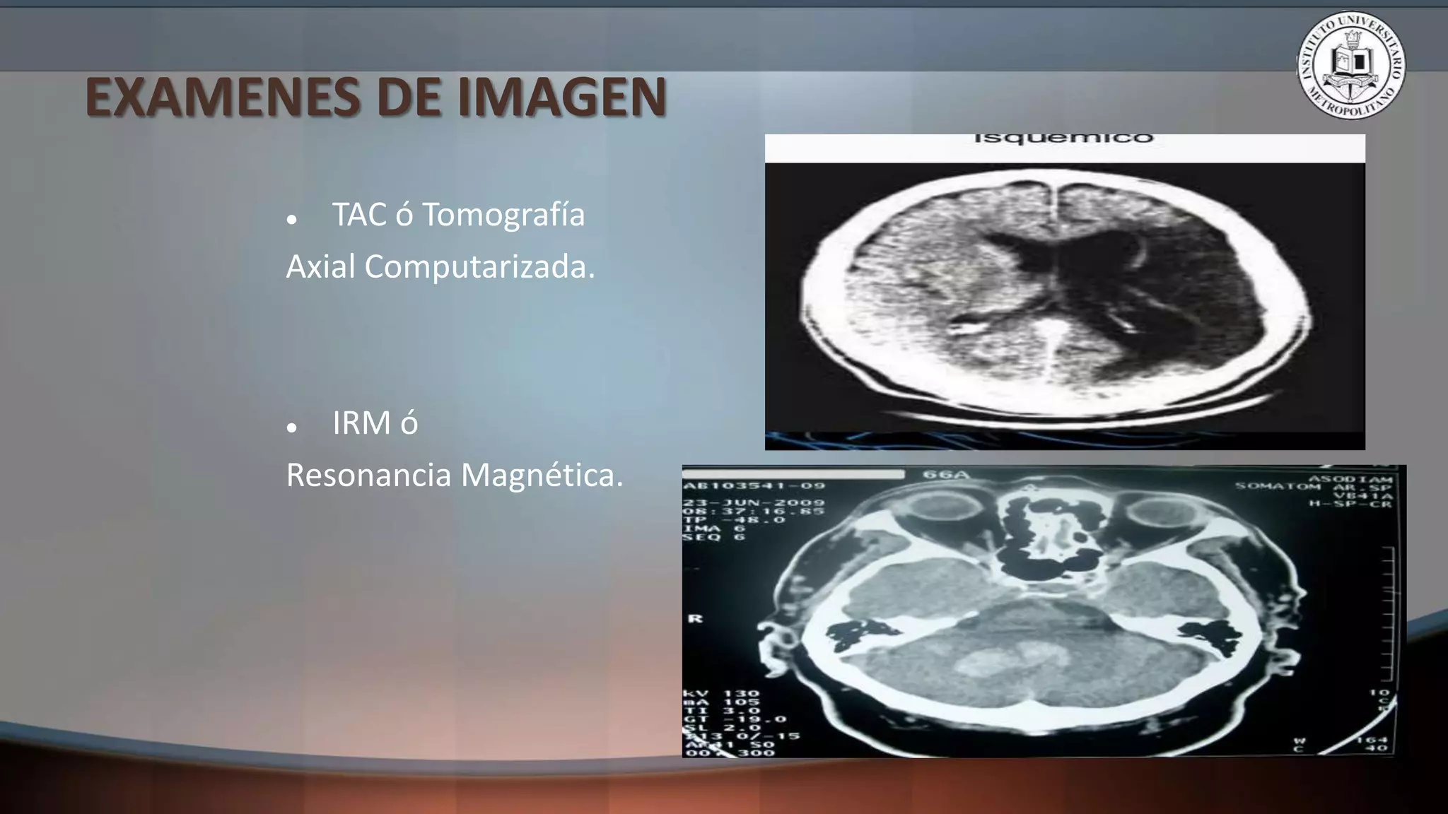 Evento vascular cerebral isquemico | PPTX