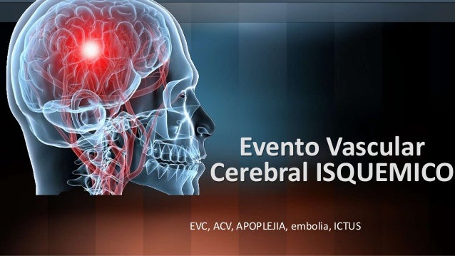 Evento vascular cerebral isquemico