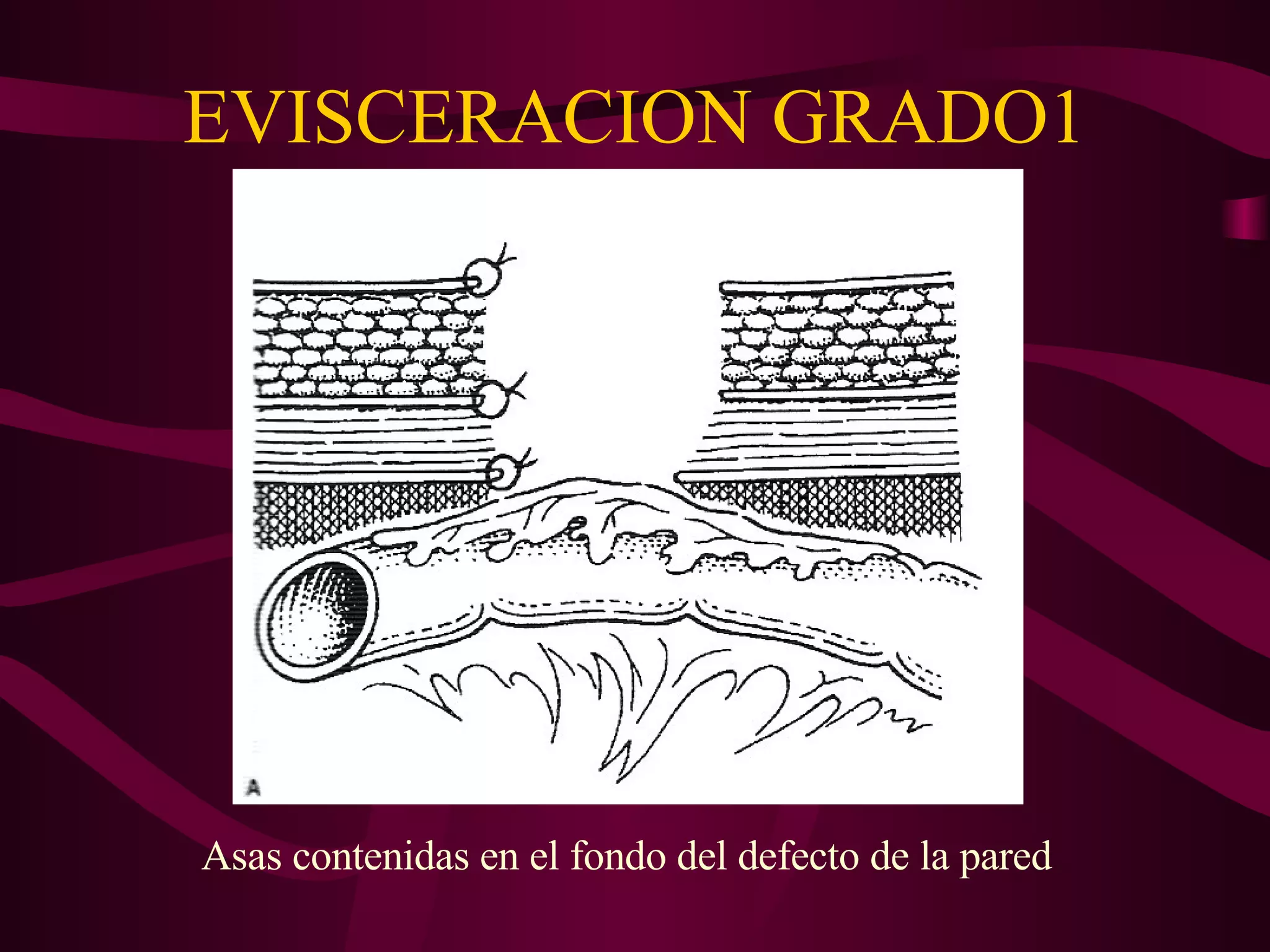 Eventraciones | PPT