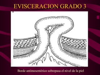 Eventraciones | PPT
