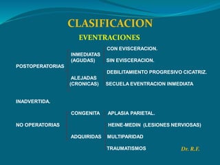 EVENTRACION EVISCERACION.pdf