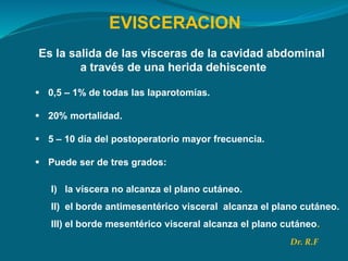 EVENTRACION EVISCERACION.pdf