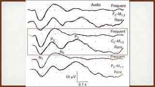 Event Related Potentials | PDF