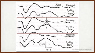 Event Related Potentials | PDF