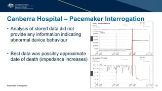 Presentation: Pacemaker investigation | PDF