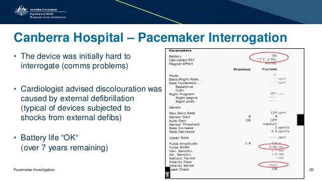 Presentation: Pacemaker investigation