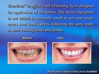 How to use Teeth Whitening kit..? | PPTX