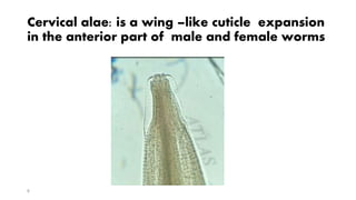 Entrobius vermicularis | PPTX