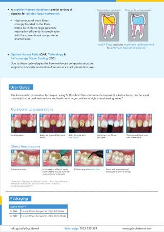 everX Flow a short-fibre reinforced flowable composite designed to ...