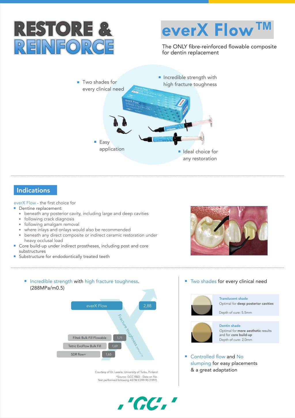 everX Flow a short-fibre reinforced flowable composite designed to ...