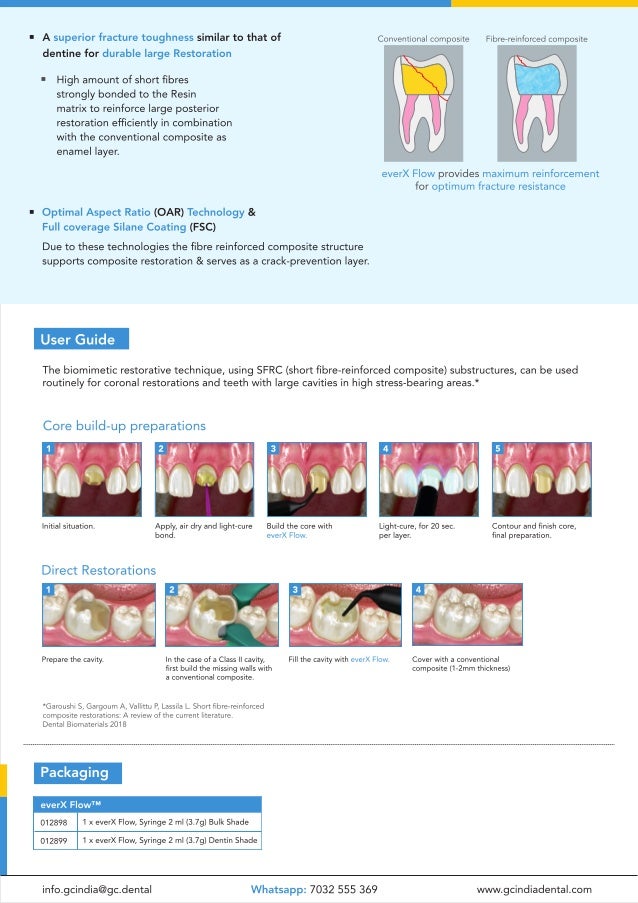 everX Flow a short-fibre reinforced flowable composite designed to ...