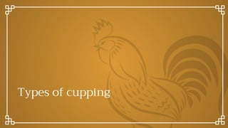 Everything about cupping therapy | PPTX