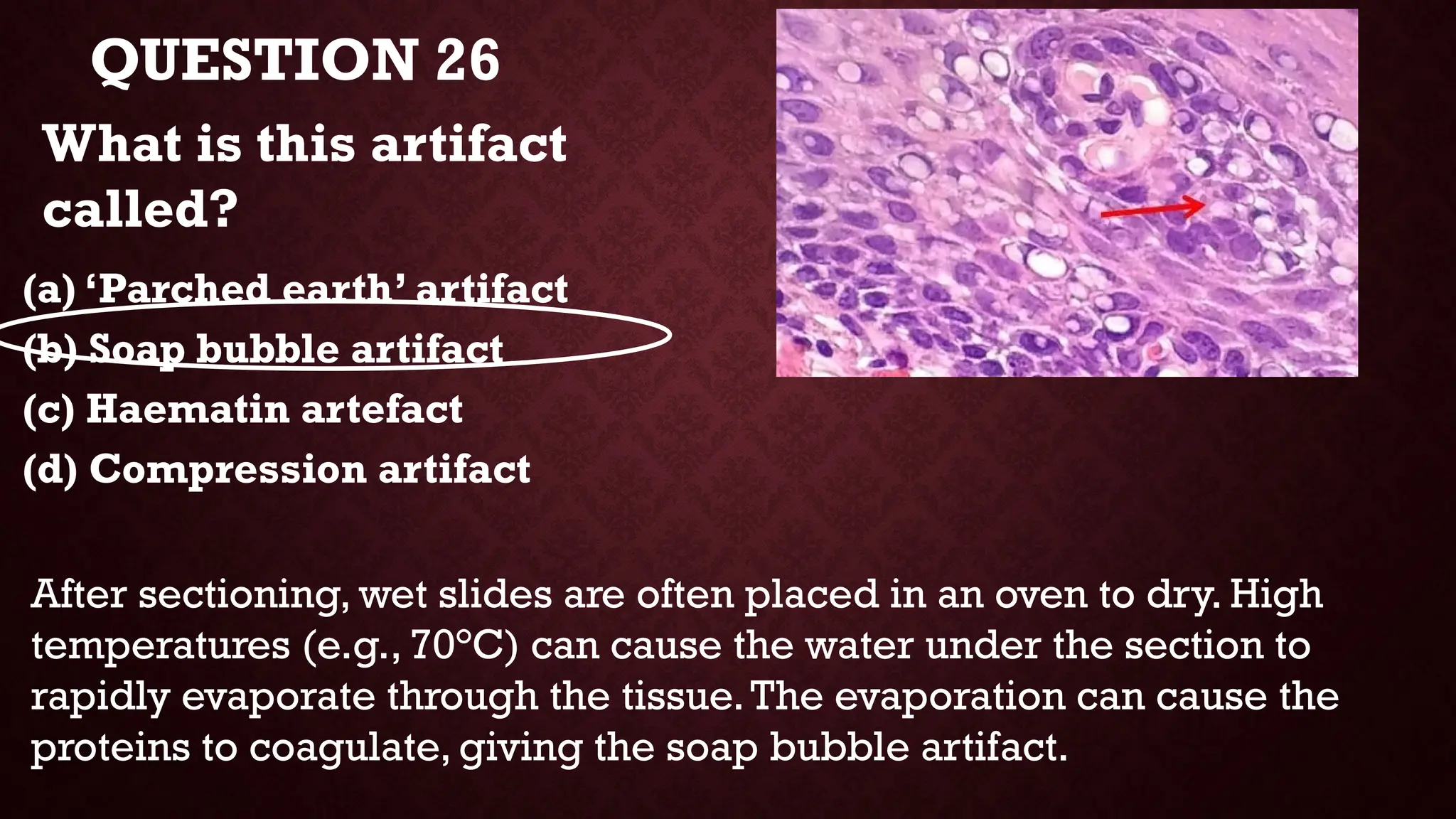 everything you need to know about H & E staining | PPTX