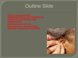 Evidence based acupuncture | PPT