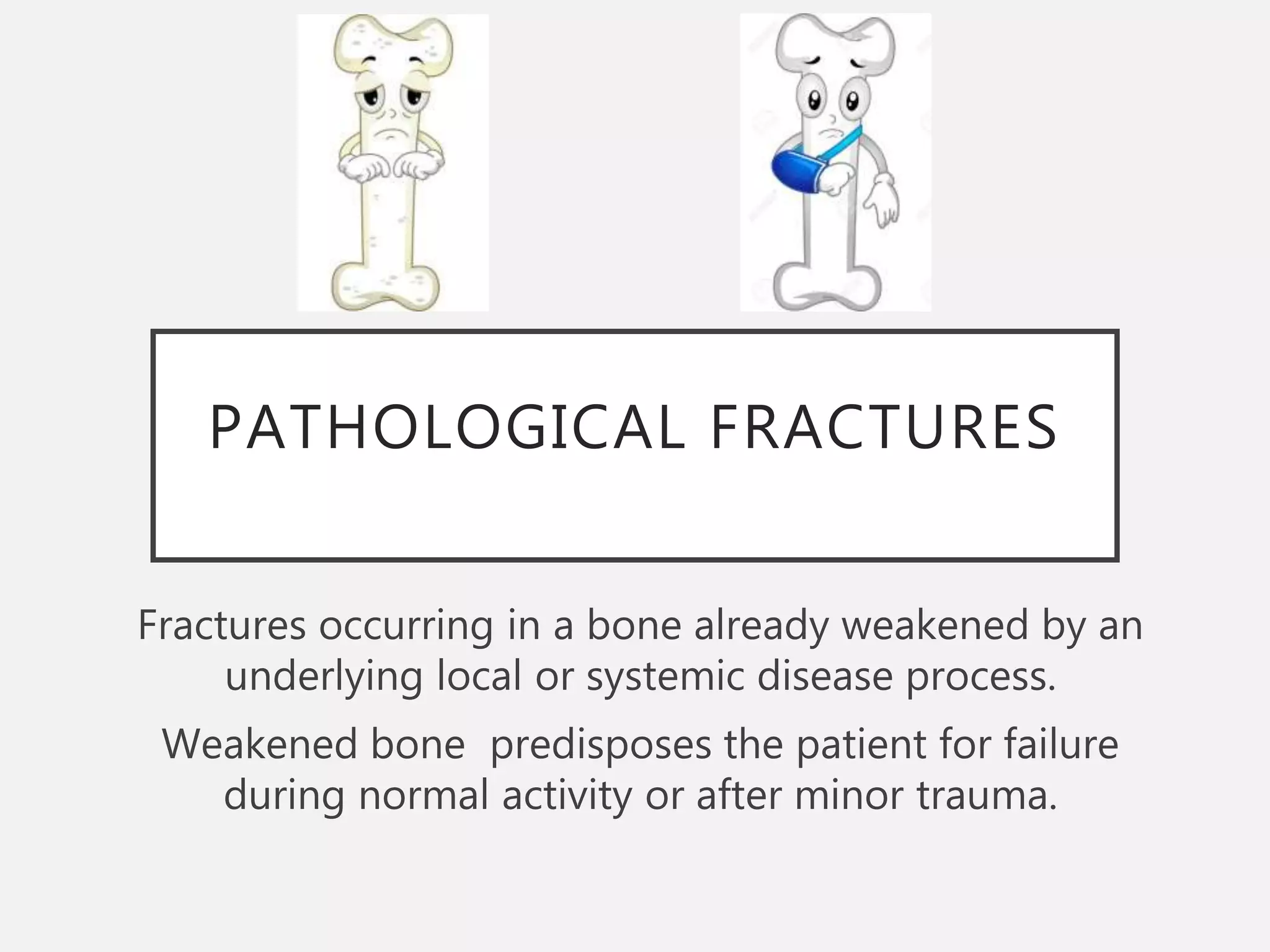 Bone tumor and Pathological fractures seminar and evidence based ...