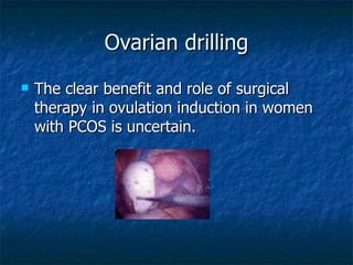 Evidence based PCOs | PPT