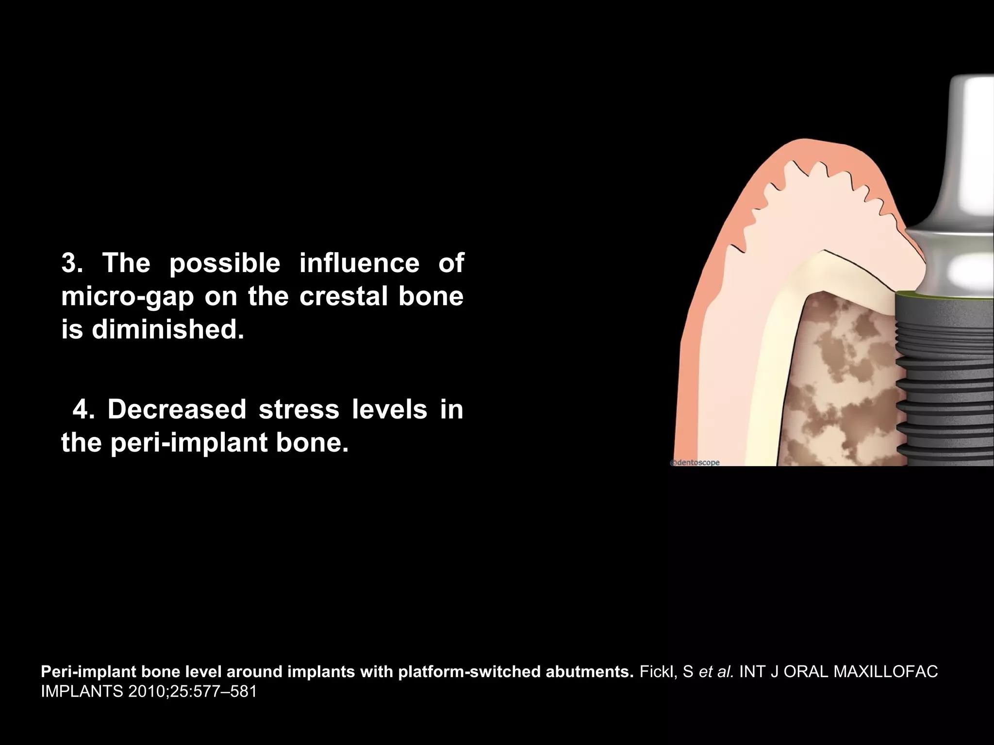 Evidence Based Prospection of Switching Platform in Dental Implants | PPT