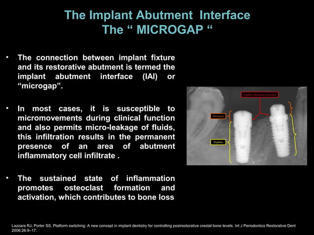 Evidence Based Prospection of Switching Platform in Dental Implants ...
