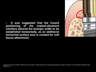 Evidence Based Prospection of Switching Platform in Dental Implants ...
