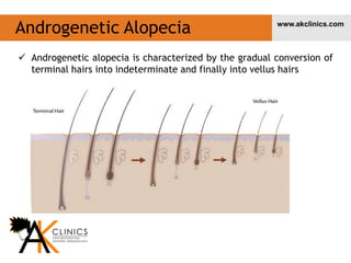 The CME on treatment of Androgenetic ‪Alopecia‬ in ‪Ludhiana‬ | PPTX