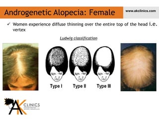 The CME on treatment of Androgenetic ‪Alopecia‬ in ‪Ludhiana‬ | PPTX