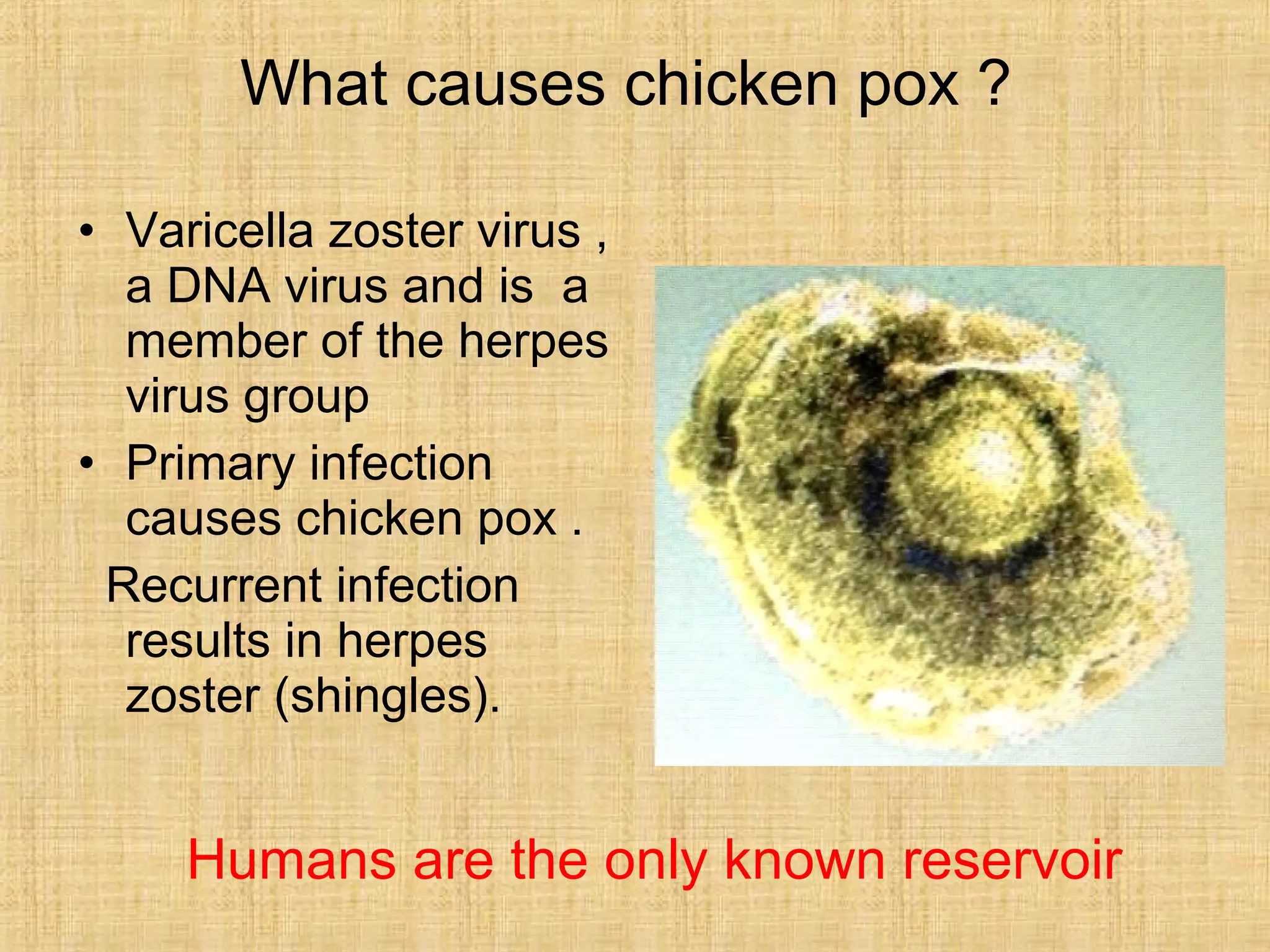 Evidence based treatment of chicken poc in pregnancy | PPT