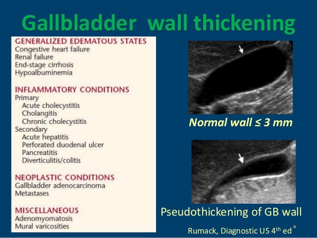 Evidence-based gallbladder diseases