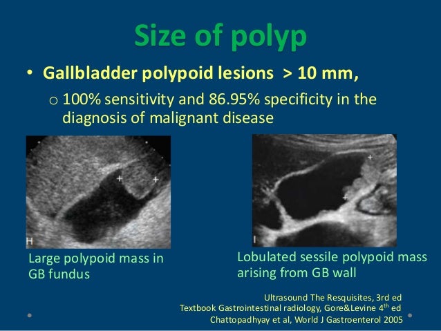 Evidence-based gallbladder diseases