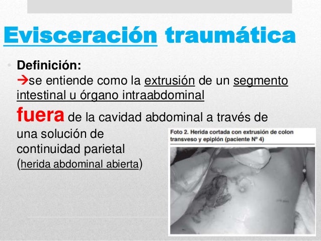 Evisceración traumática