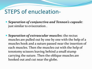 Evisceratio and enucleation(1) | PPTX