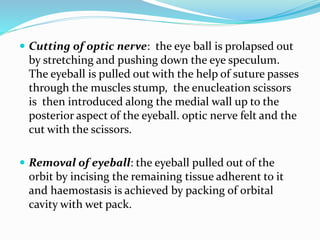 Evisceratio and enucleation(1) | PPTX