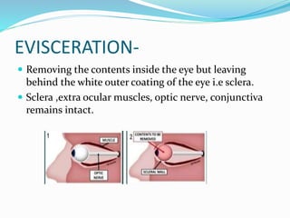 Evisceratio and enucleation(1) | PPT