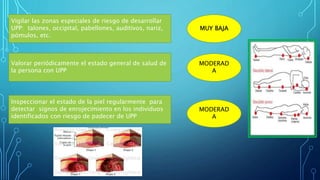 ULCERAS POR PRESIÓN (UPP) EVITANDO / EVARUCI | PPTX