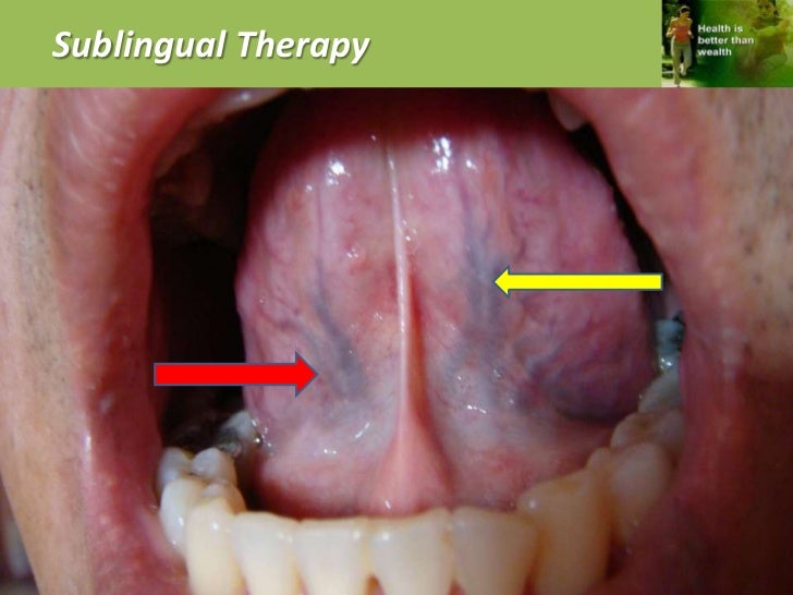 EVO presentation by www.efi2u.biz