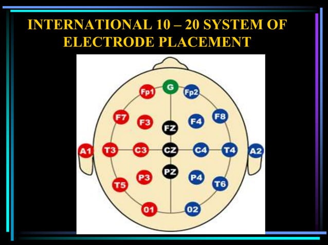 Evoked potential - An overview | PPT | Brain and Nervous System ...