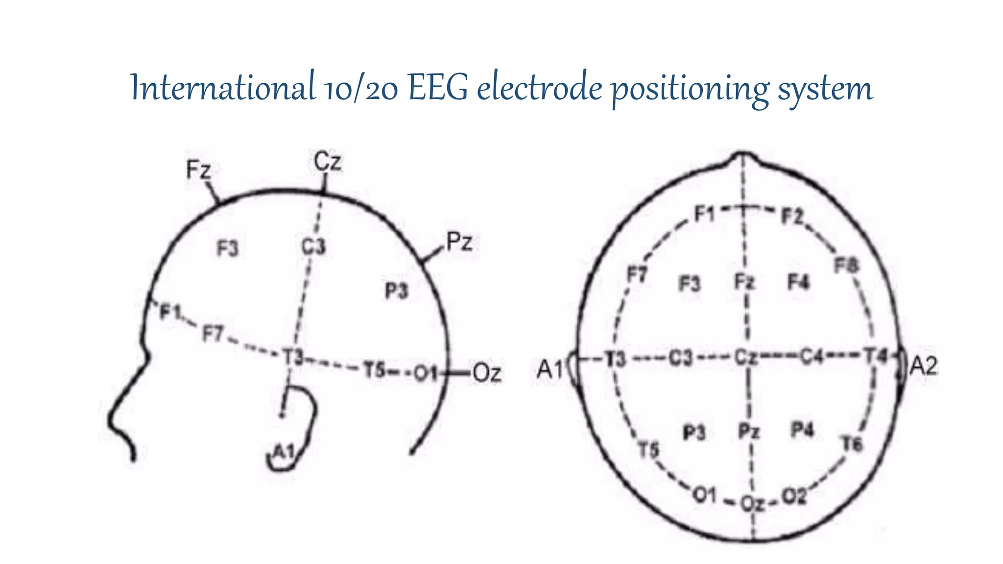 Evoked Potentials.pptx