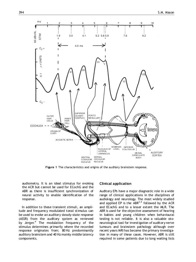 Evoked potentials and their clinical application