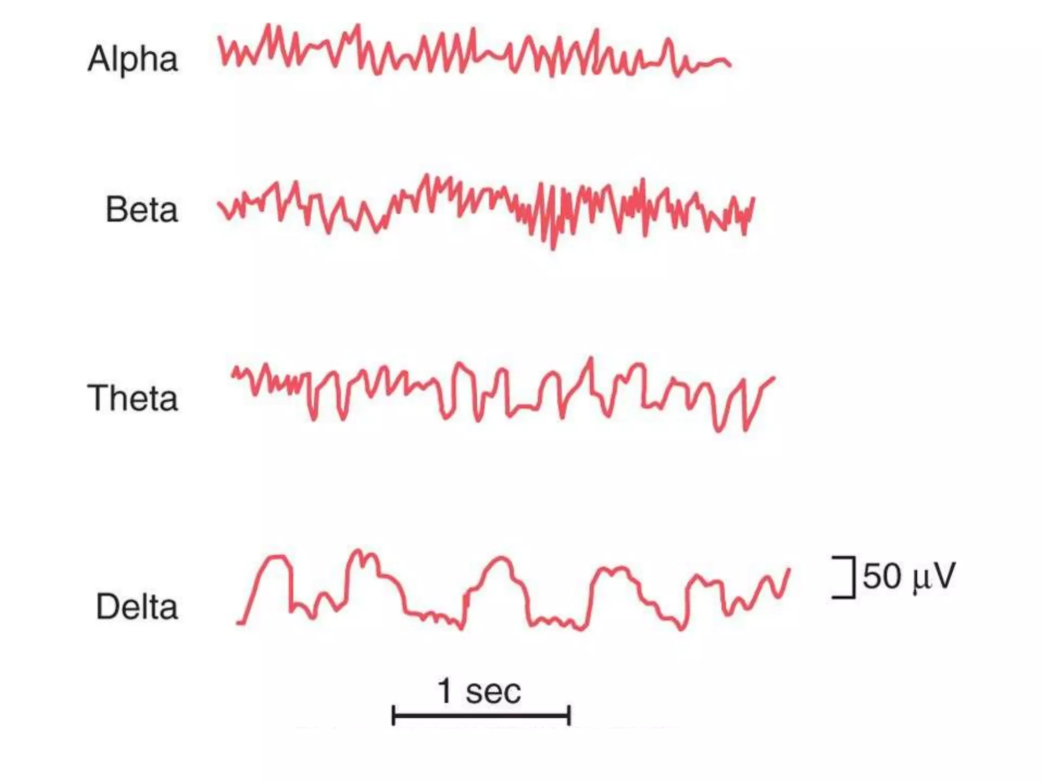 Evoked potentials, clinical importance & physiological basis of ...