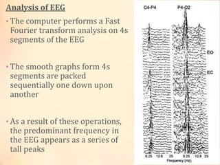 Evoked potentials, clinical importance & physiological basis of consciousness, eeg changes in ...